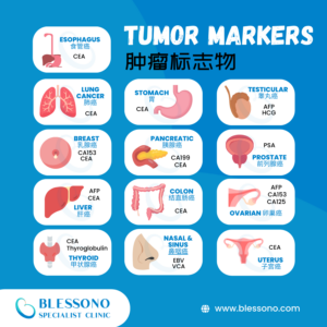 Understanding the Importance of Tumor Markers | Blood Test Malaysia