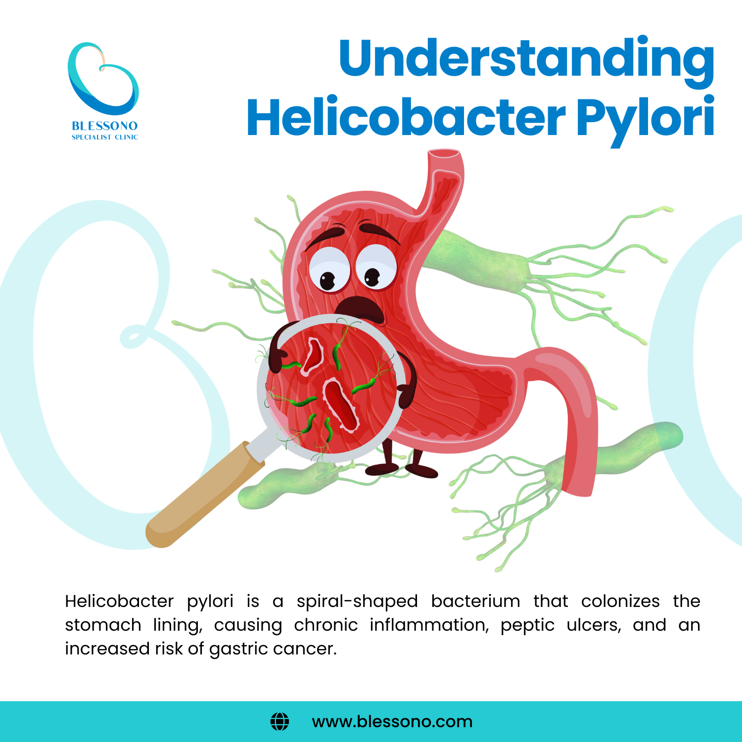 5 Essential Insights into Helicobacter pylori