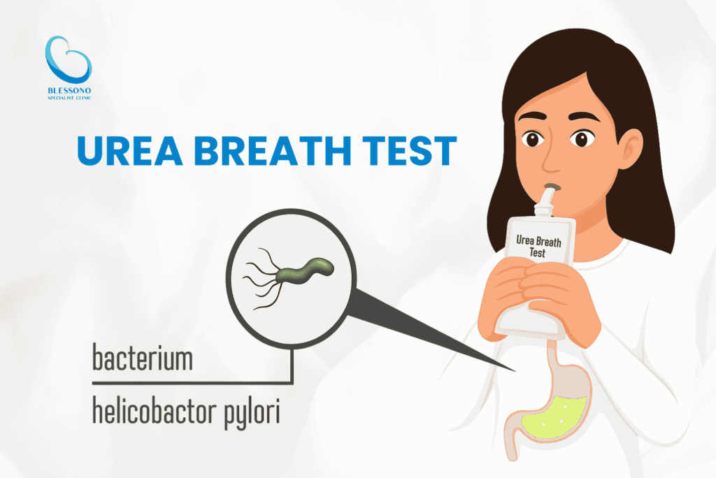 Urea Breath Test (H. pylori) | Medical Check Up Malaysia