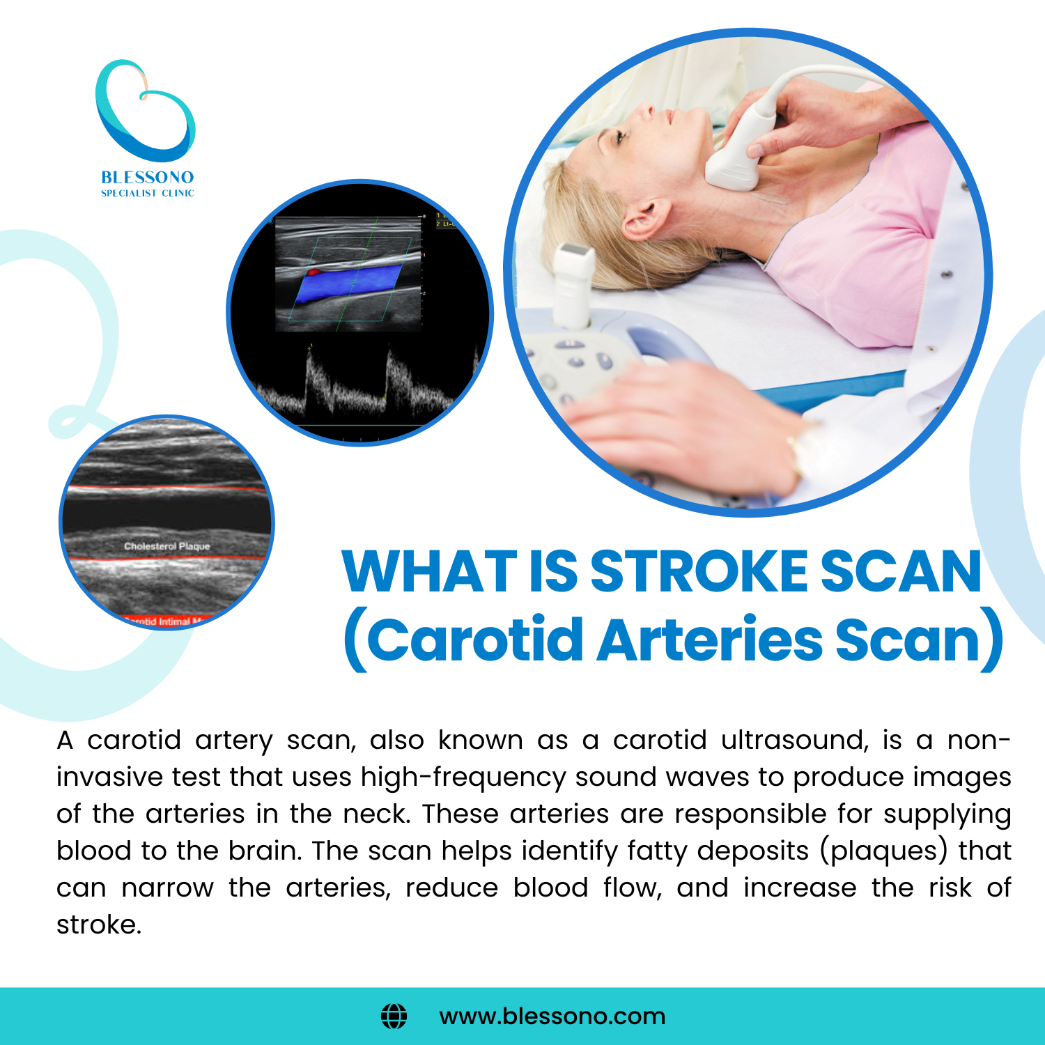 Why You Need to Perform a Carotid Arteries Scan