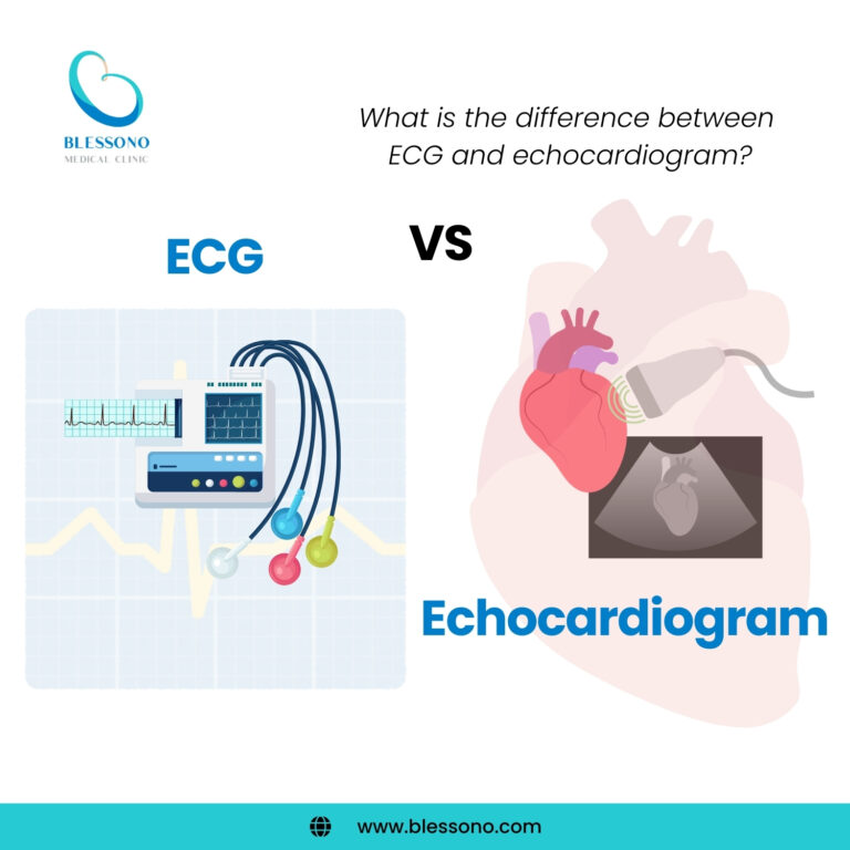 What is the Difference Between ECG and Echocardiogram? | Blessono ...
